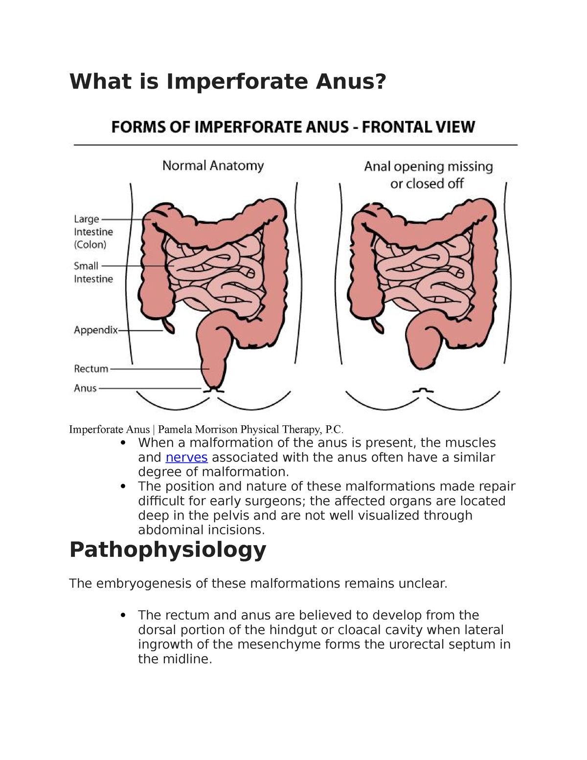 What Is Imperforate Anus What Is Imperforate Anus Imperforate Anus