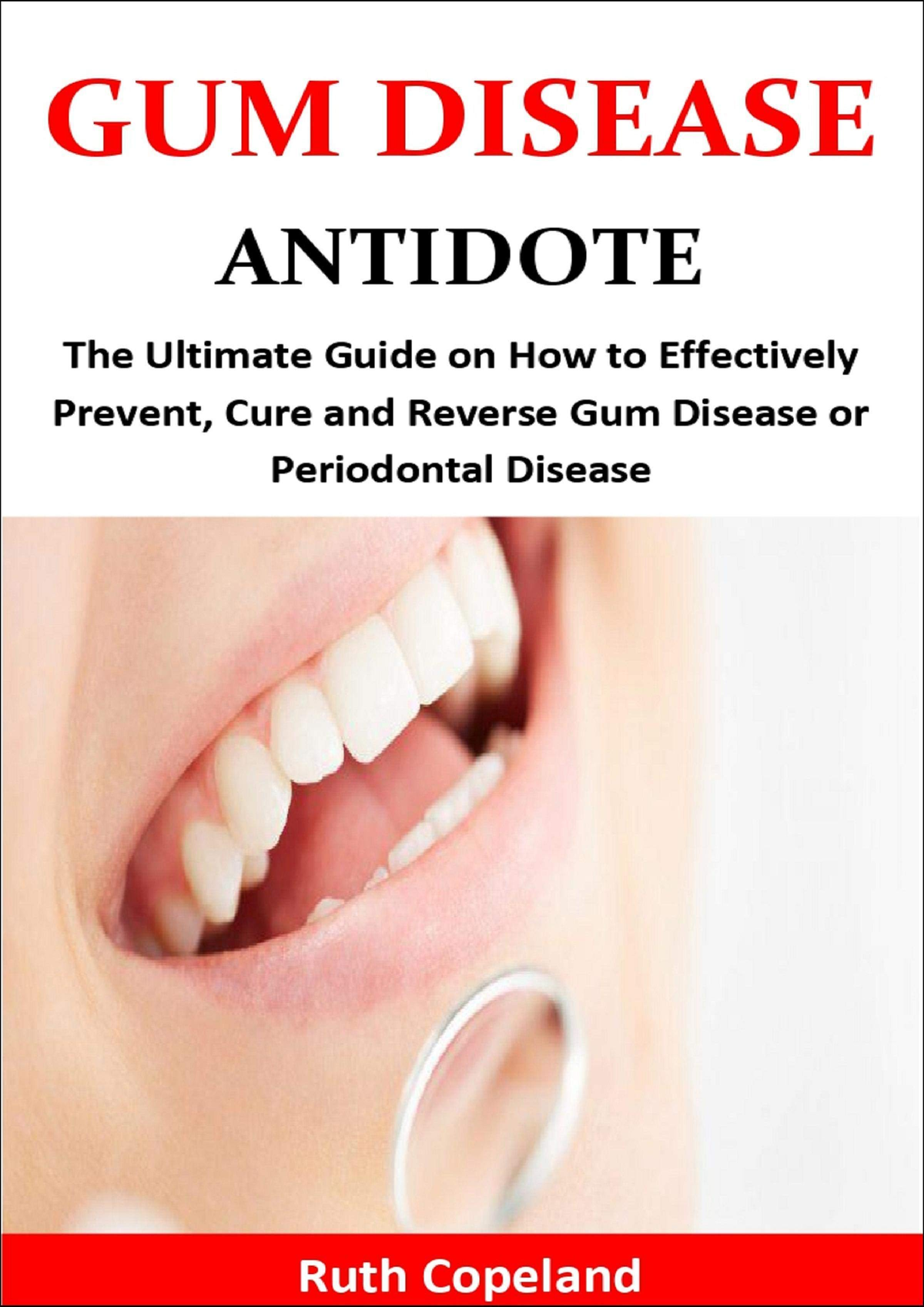 Read Pdf Gum Disease Antidote The Ultimate Guide On How To Effectively