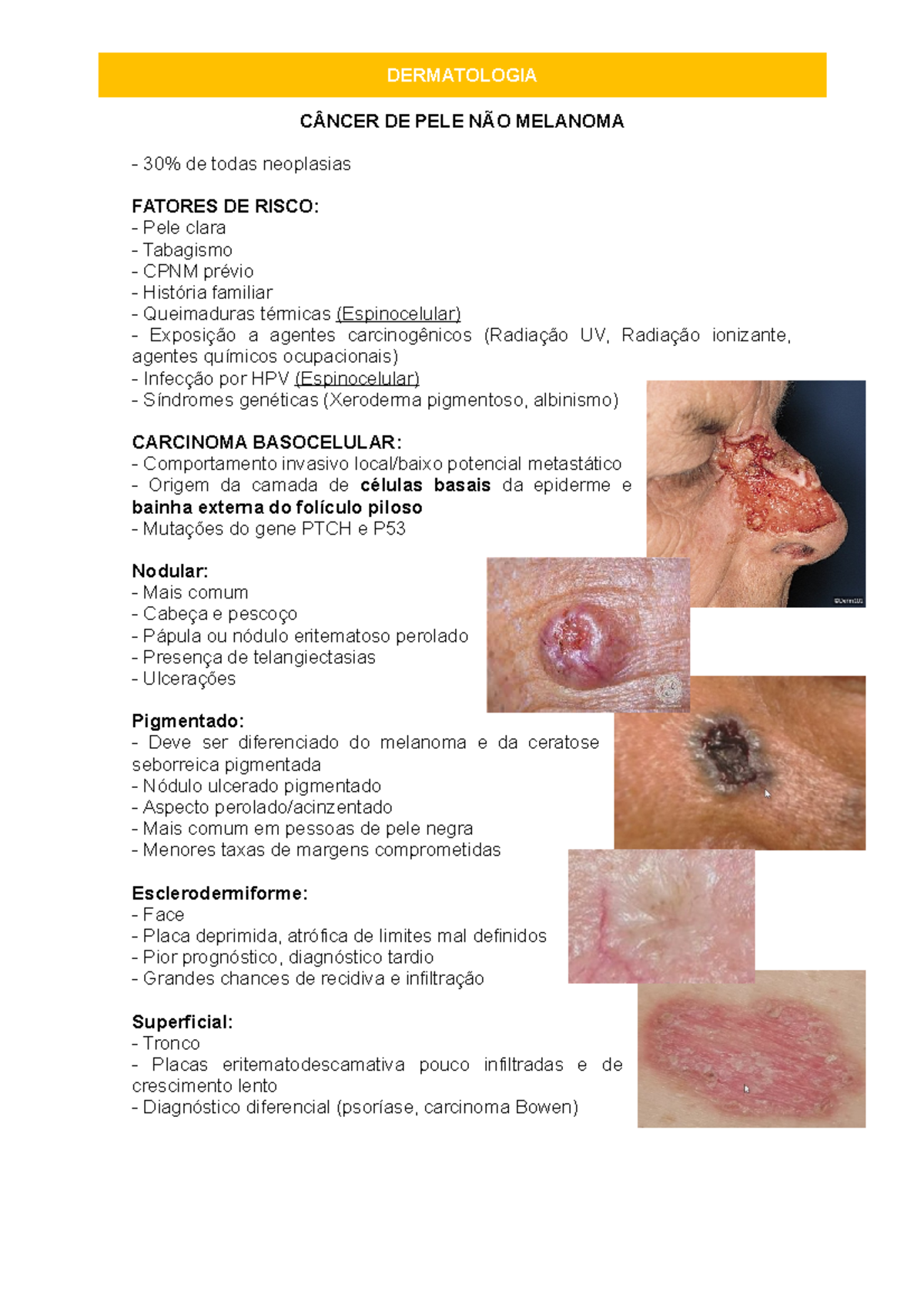 Câncer De Pele Não Melanoma Dermatologia CÂncer De Pele NÃo Melanoma