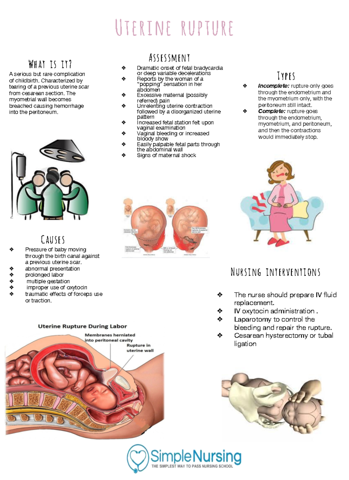 Uterine Rupture Simple Nursing Uterine Rupture Assessment Dramatic