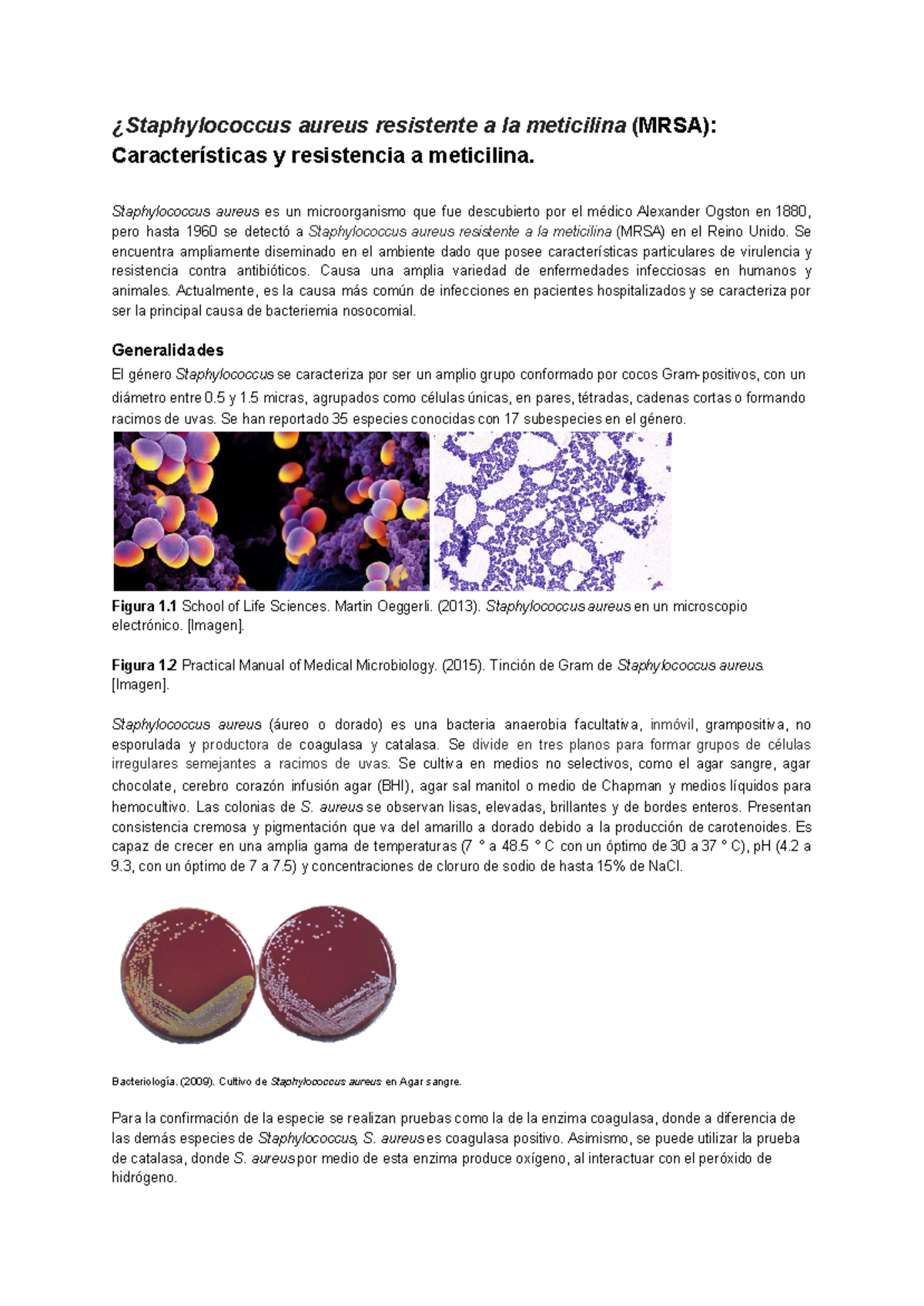 Staphylococcus Aureus Características Y Su Resistencia A Meticilina