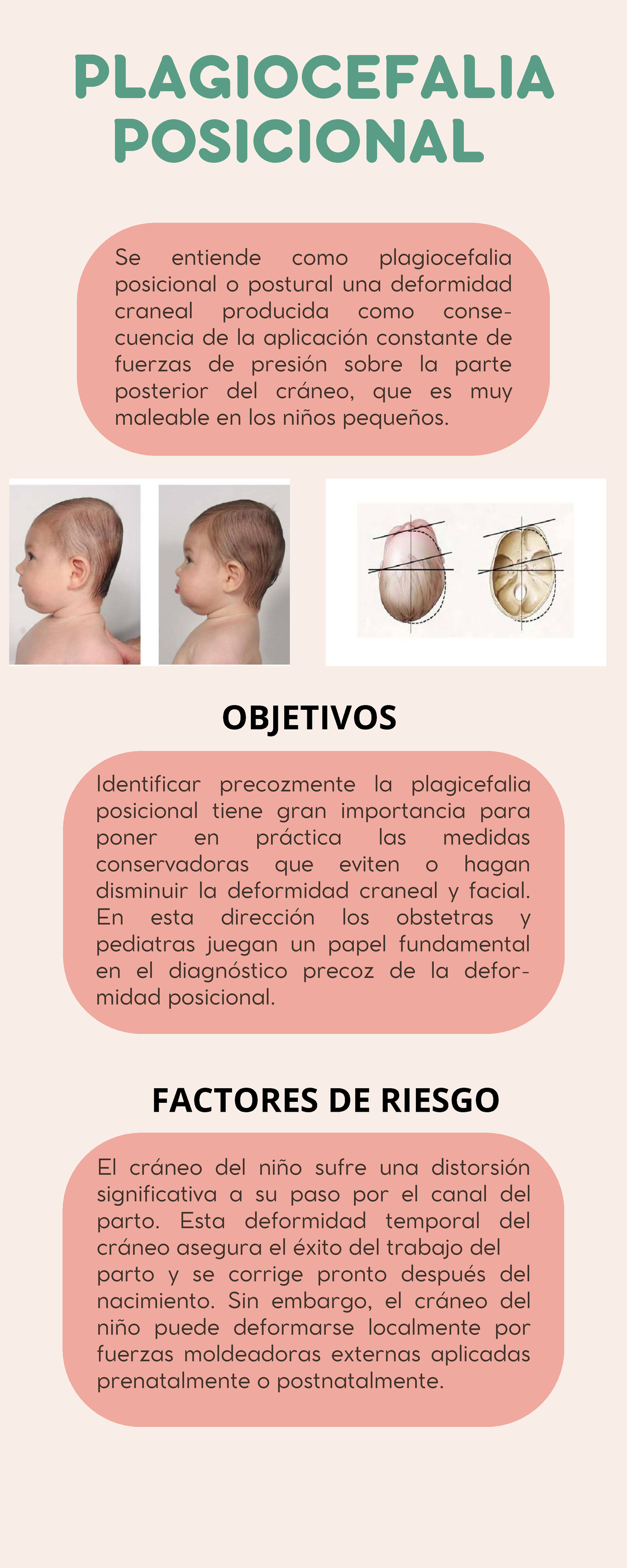 C 10 Infografia Resumen Se Entiende Como Plagiocefalia Posicional O