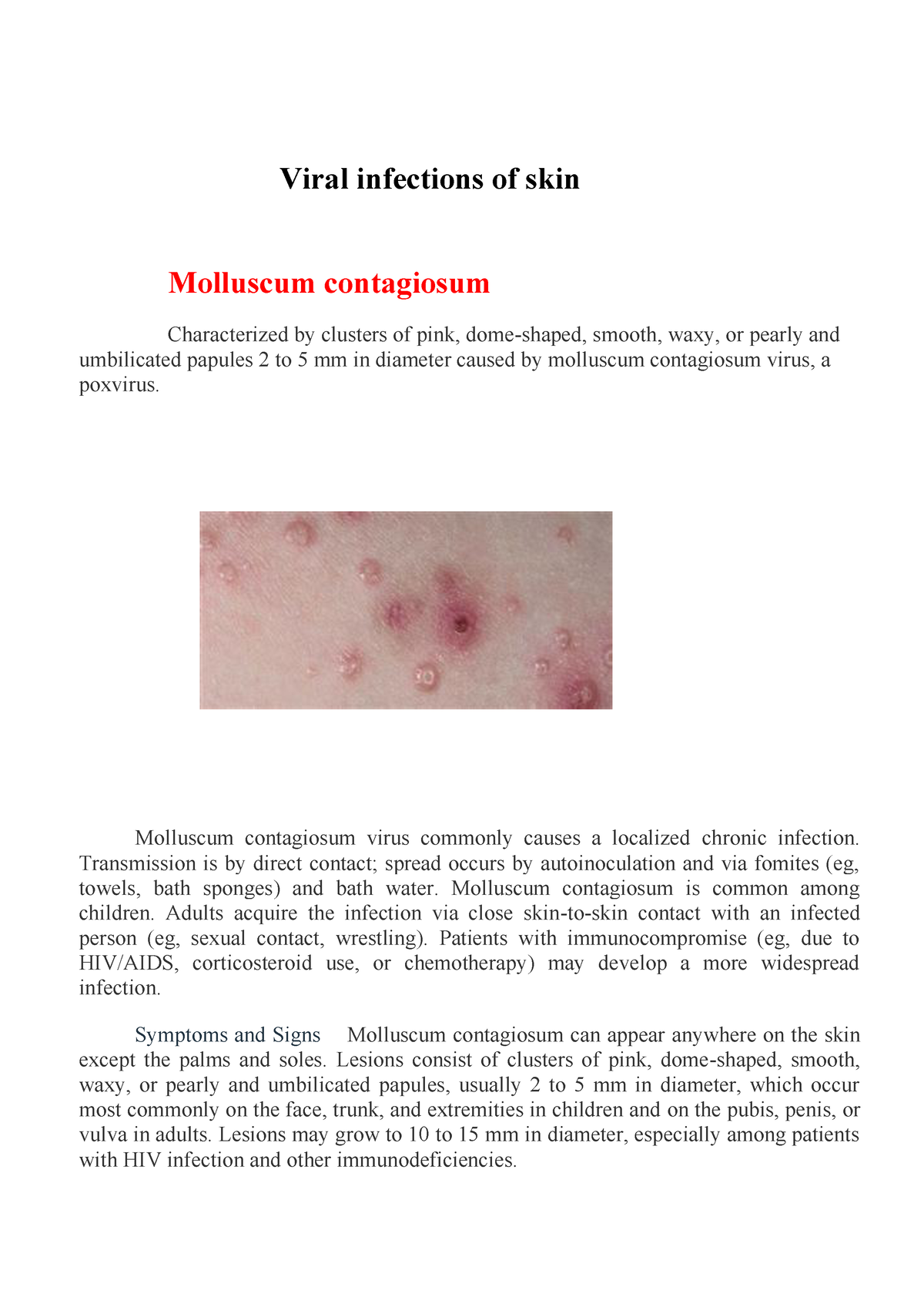 Viral Infections Of Skin Viral Infections Of Skin Molluscum