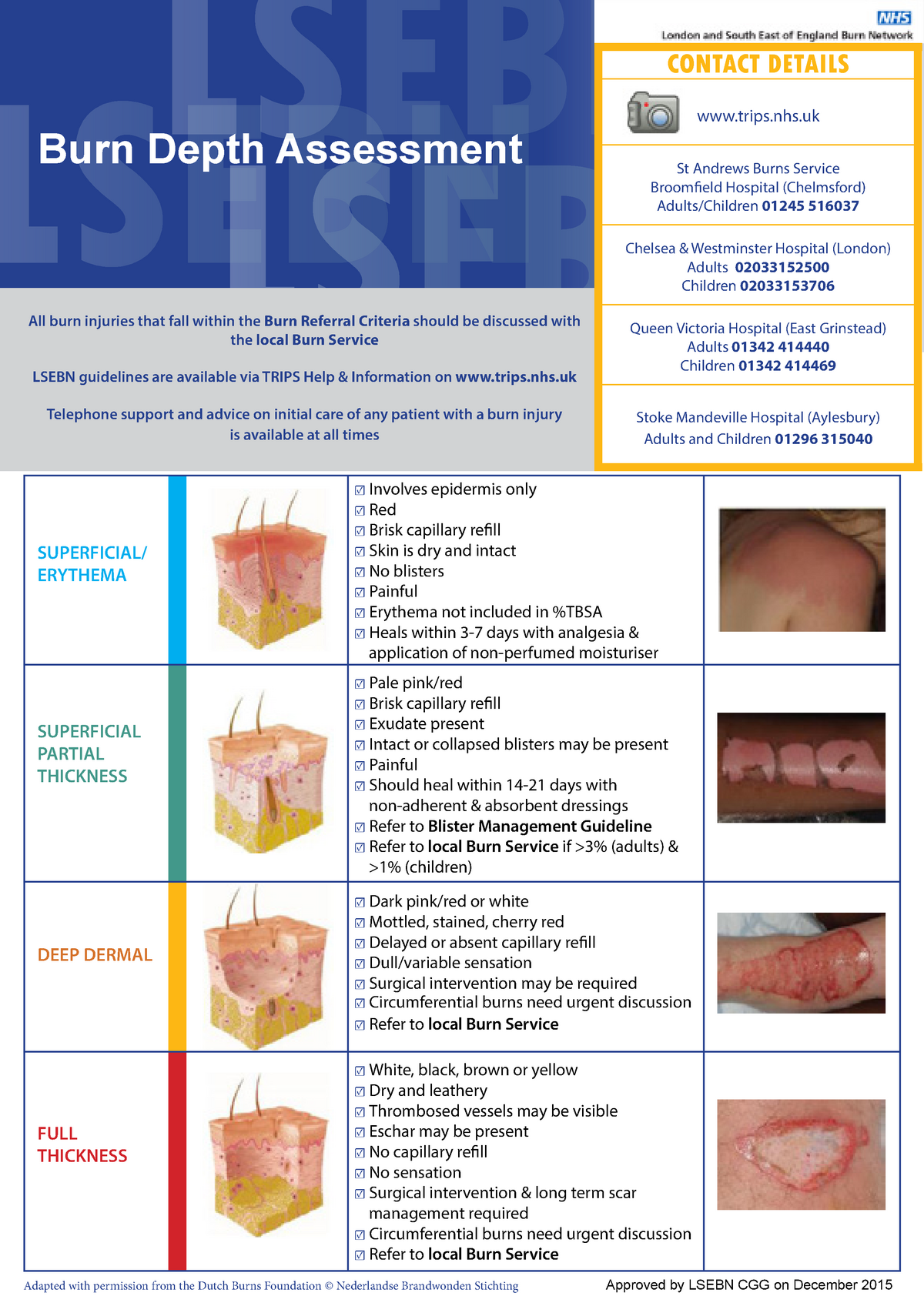 Lsebn Burns Depth Assessment Lsebn Lsebn Burn Depth Assessment Lsebn