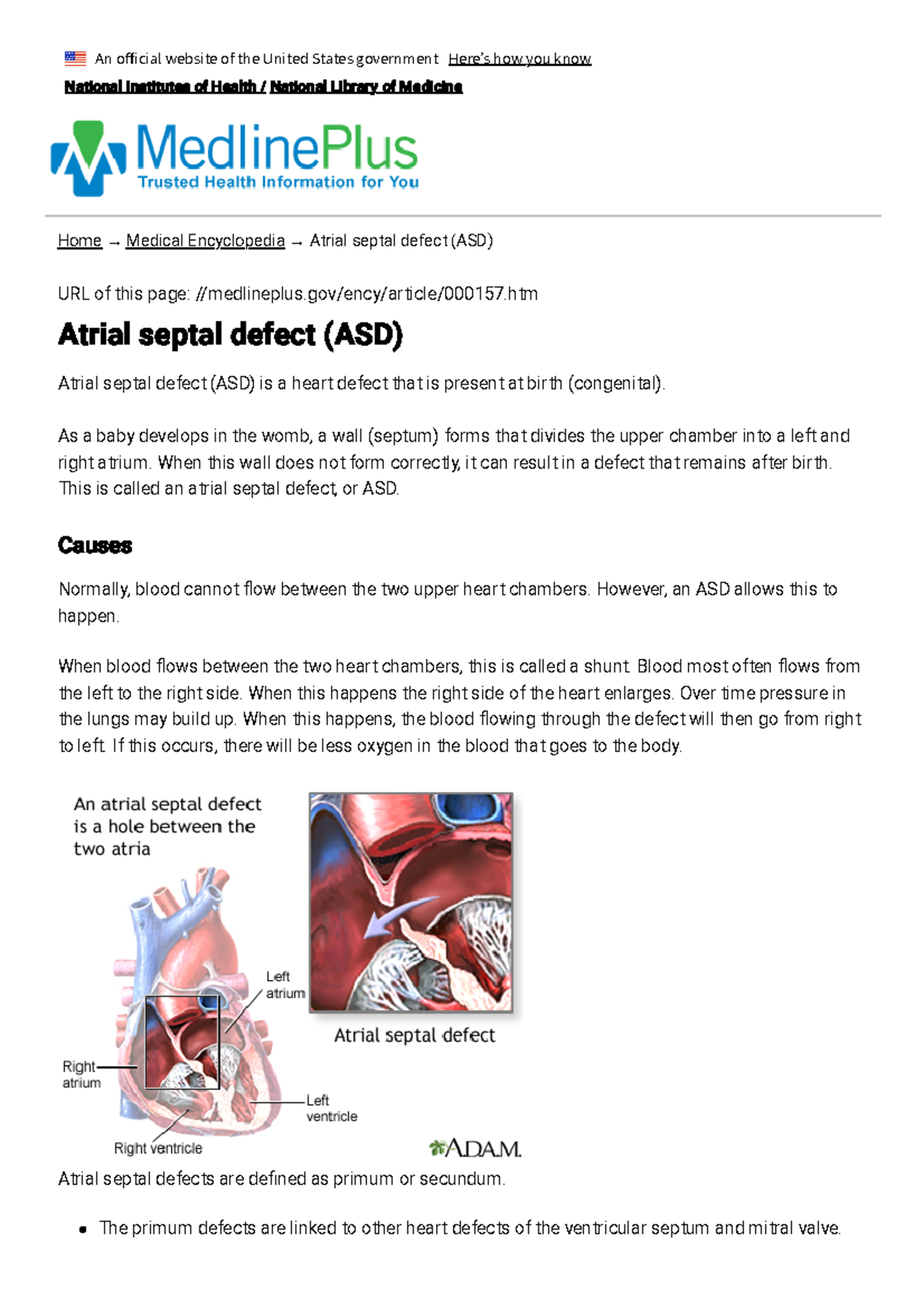 Atrial Septal Defect Asd Medline Plus Medical Encyclopedia Home →