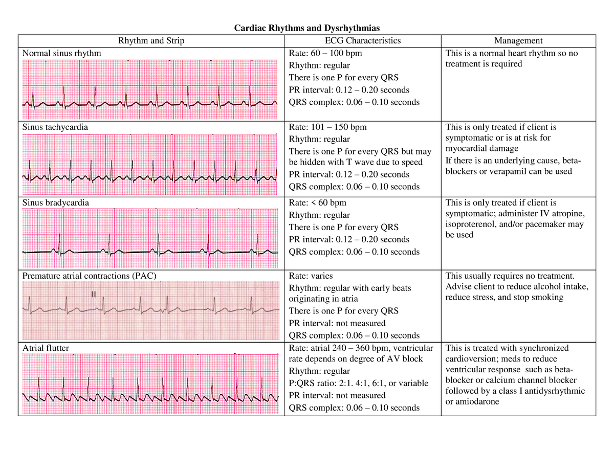 Cardiac Dysrhythmias Cardiac Rhythms And Dysrhythmias Rhythm And