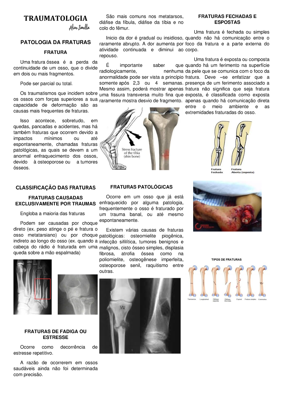 Traumatologia Traumatologia Aline Zanella Patologia Da Fraturas