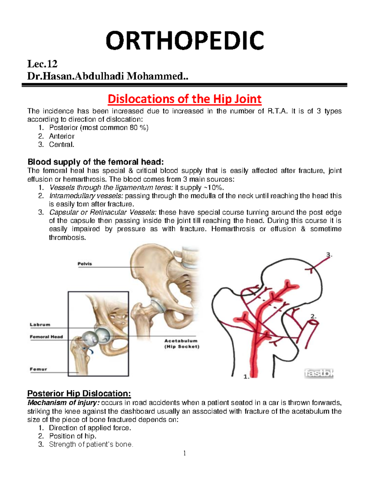 Dislocations Of The Hip Joint Orthopedic Lec Drhasan Mohammed