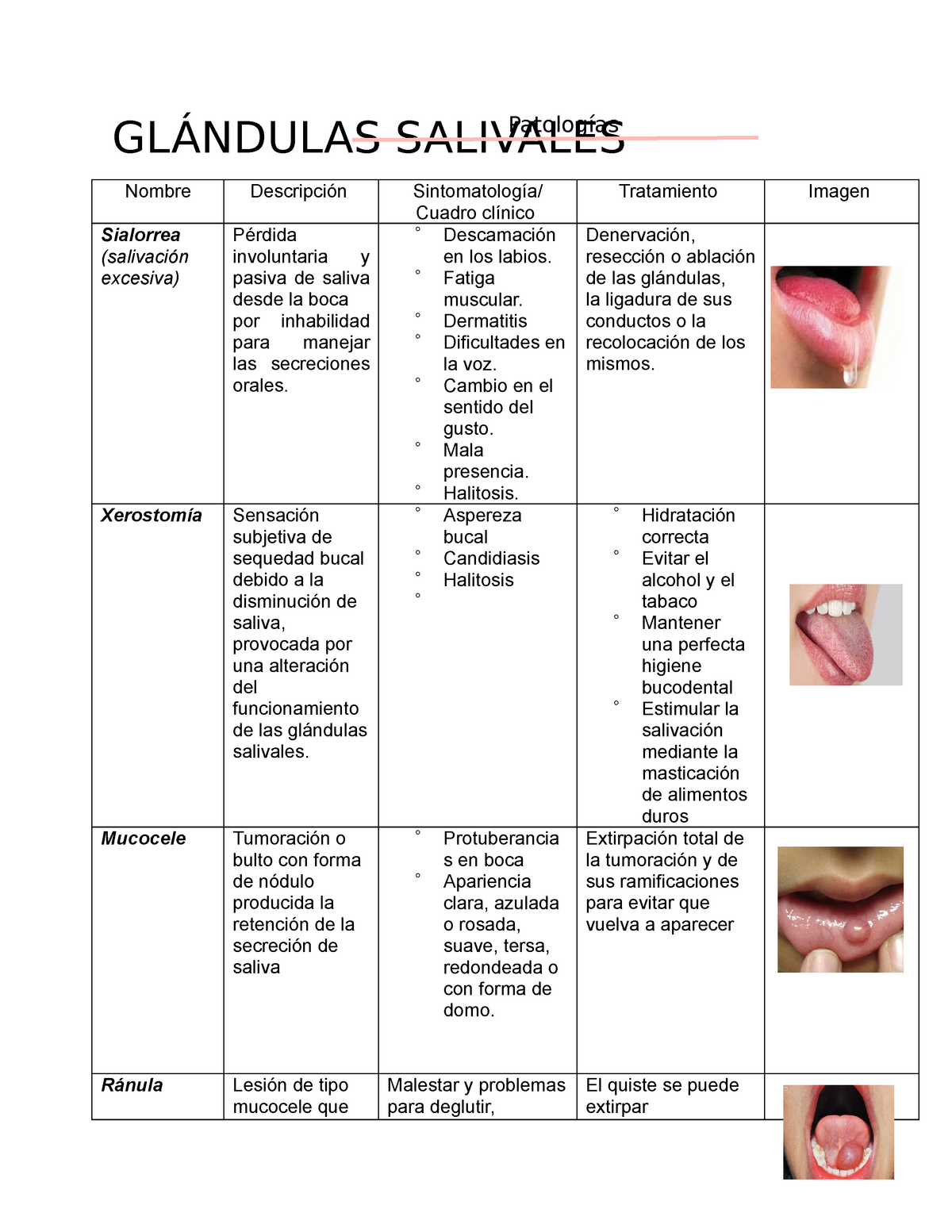 Cuadro Comparativo De Glandulas Salivales Cuadr O Comparativo De Las