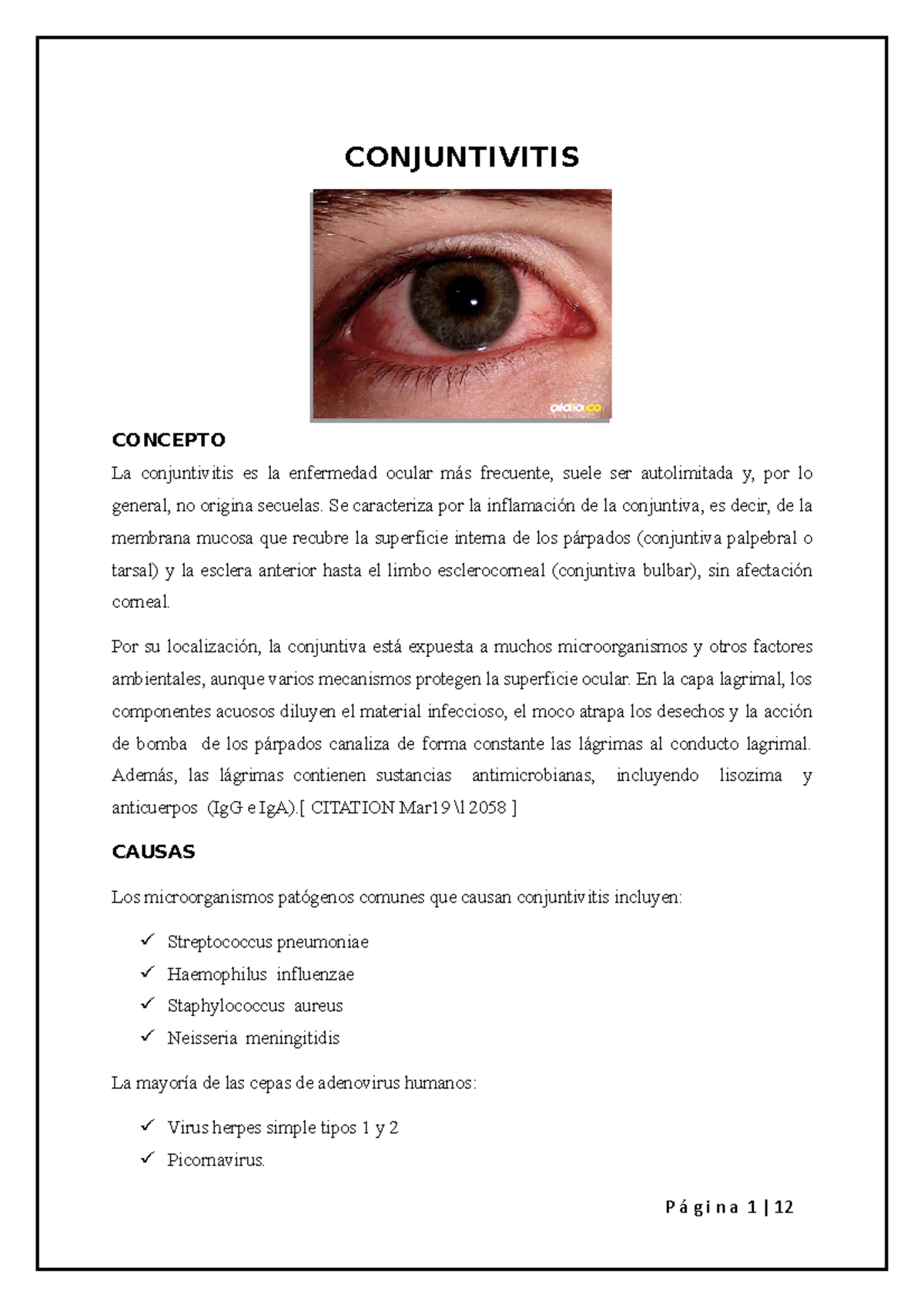 Conjuntivitis Nota 10 Conjuntivitis Concepto La Conjuntivitis Es