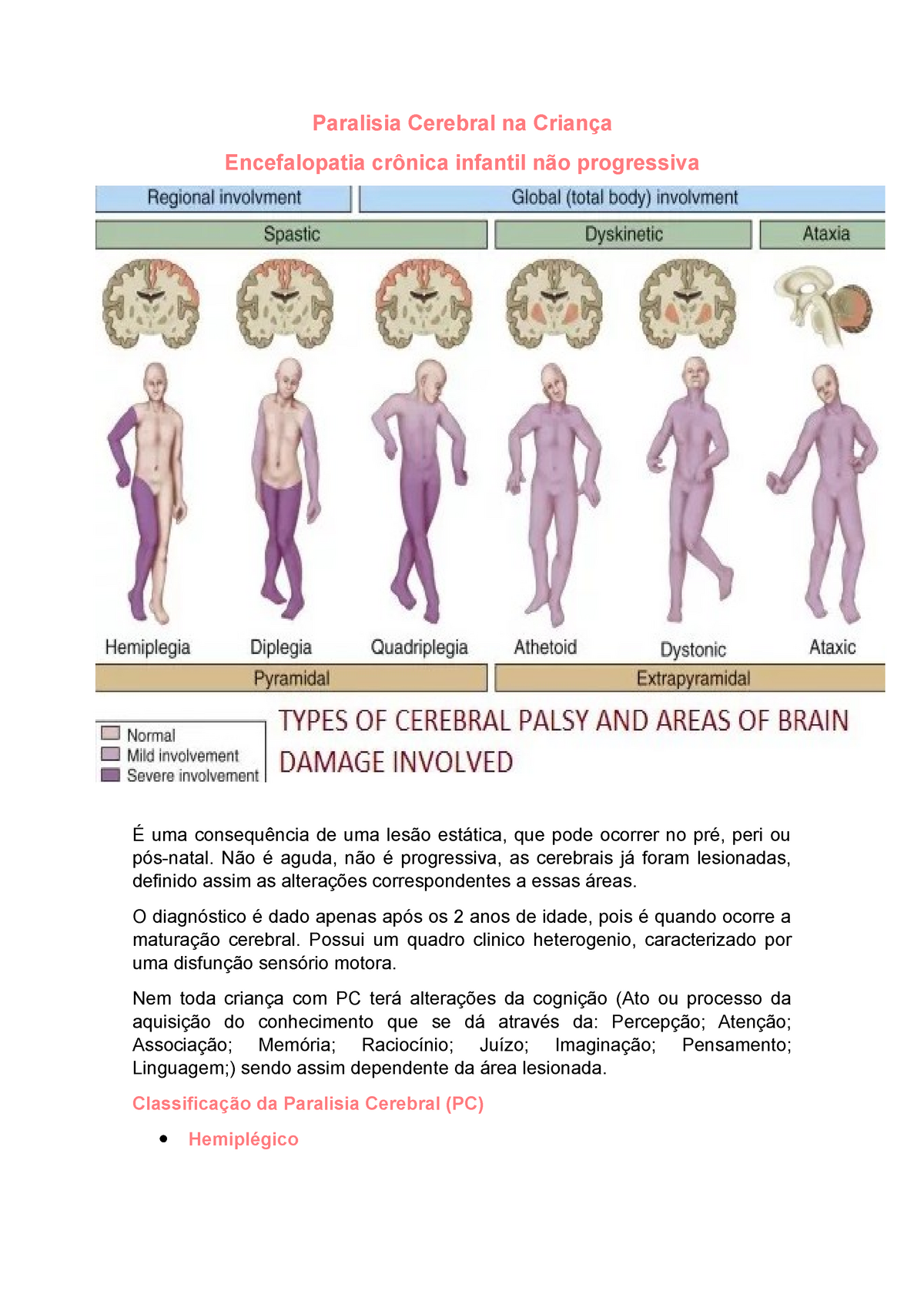 Fisiopatologia Na SaÚde Da CrianÇa Paralisia Cerebral Na Criança Pc