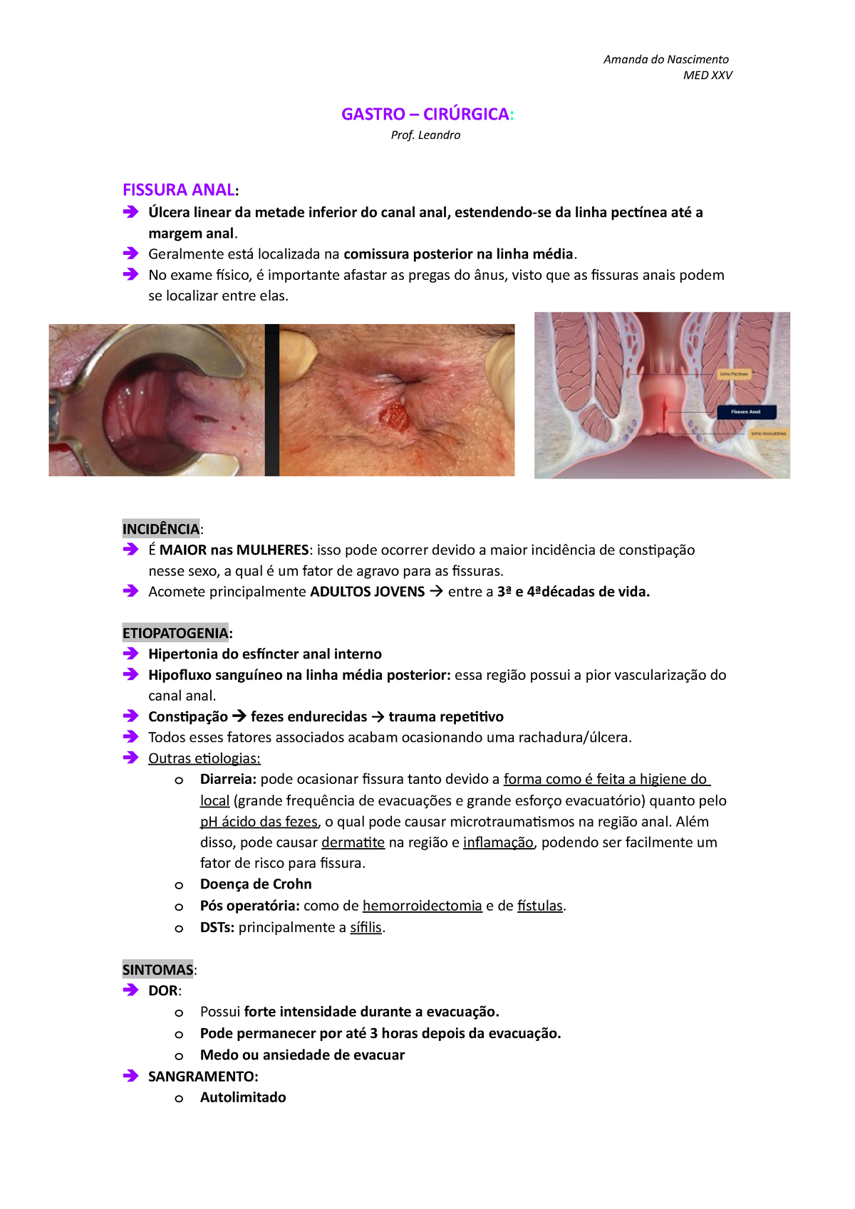 9 Resumo Fissura Anal E Processos Infecciosos Do Canal Anal E ânus