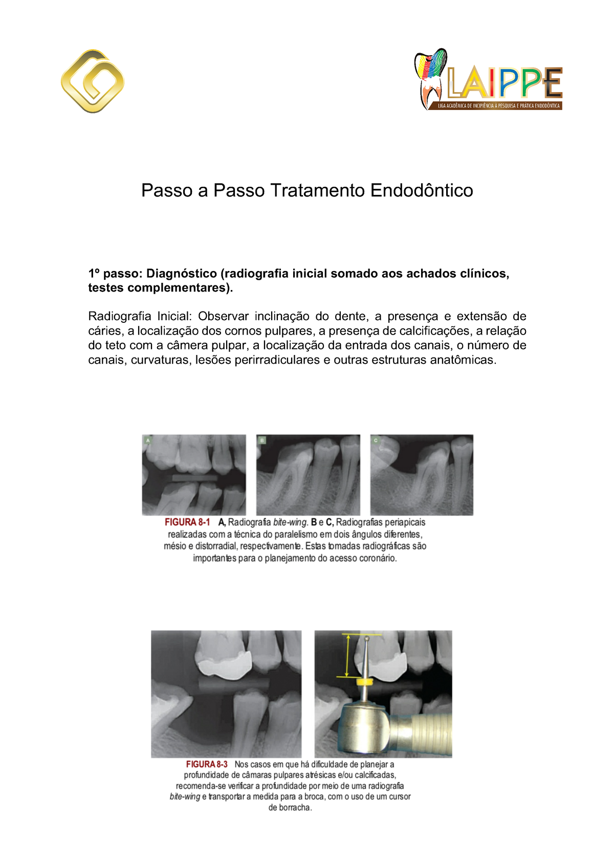 Passo A Passo Tratamento Endodontico Passo A Passo Tratamento