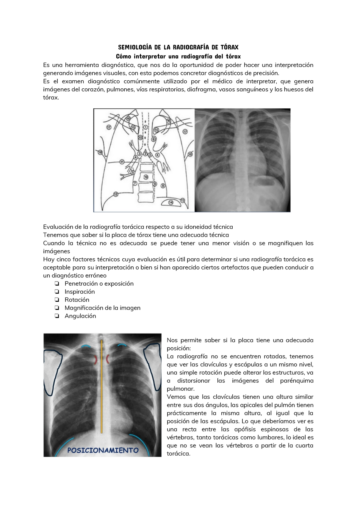 Cómo Interpretar Una Radiografia Del Tórax SemiologÍa De La