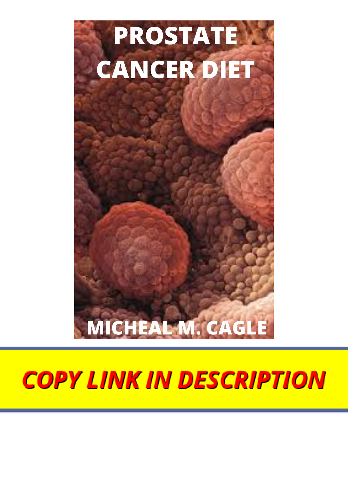 Pdf Read Online Prostate Cancer Diet Your Ultimate Guide To Treat