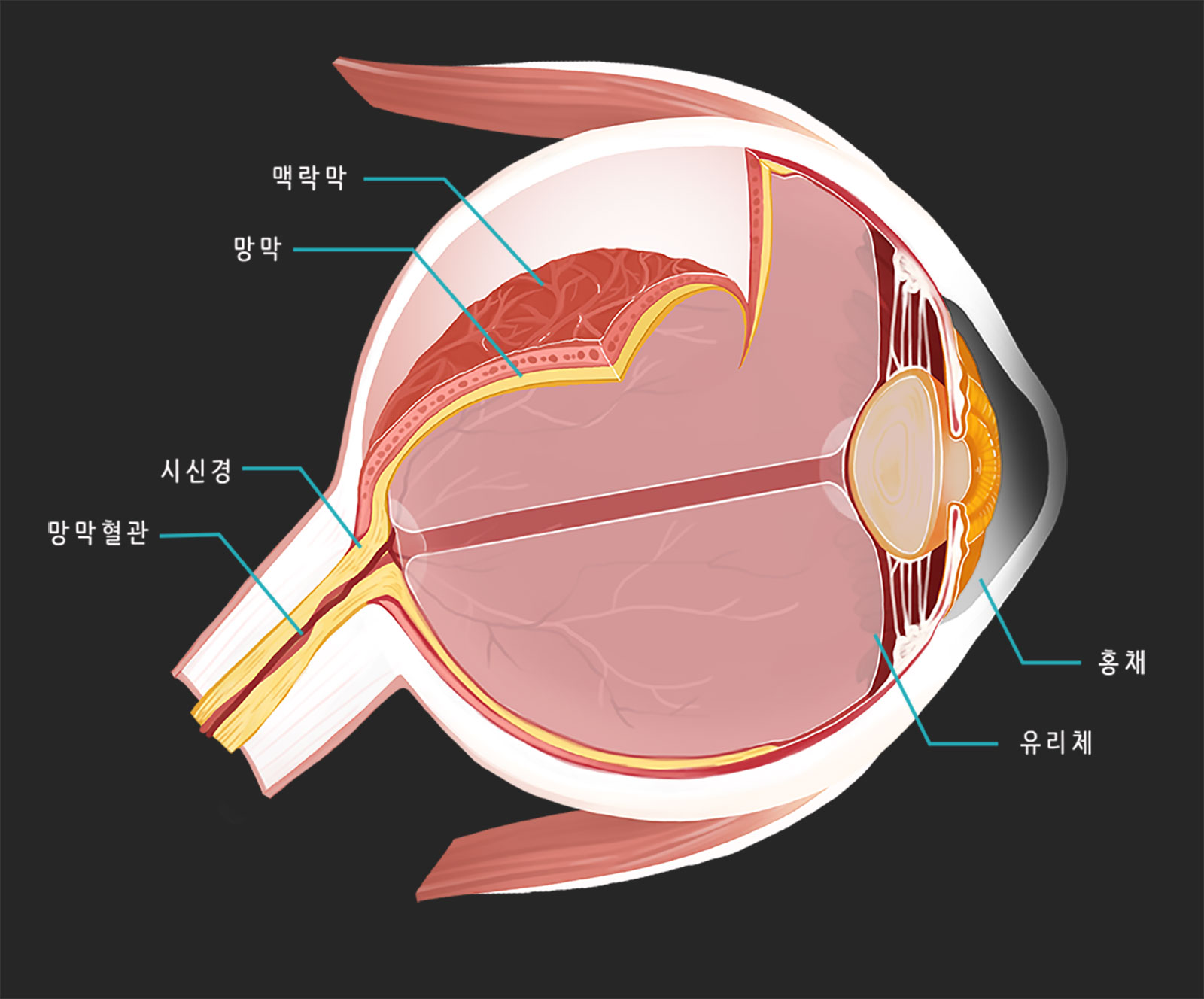 실명까지 유발하는 망막박리의 전조증상부터 종류 치료법까지 알아보기 닥터나우