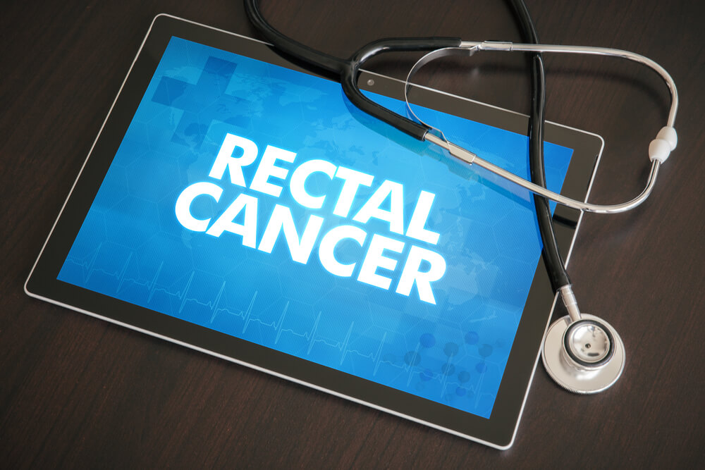 How Is Rectal Cancer Diagnosed