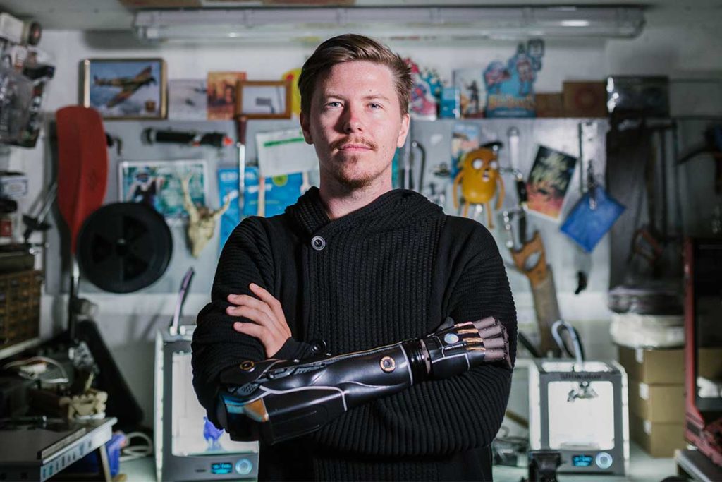 Hero Arm 3d Printed Bionic Arm Gives Below Arm Amputees A New Hope