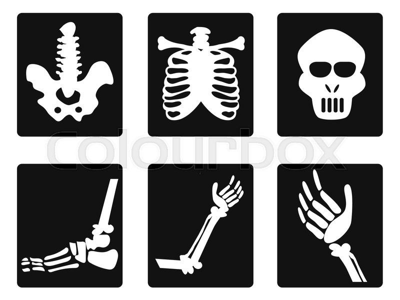 Isolated X Ray Icons On White Stock Vector Colourbox