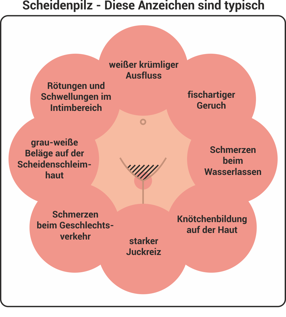 Scheidenpilz Erkennen I Symptome And Behandlung Kloster Apotheke Düsseldorf