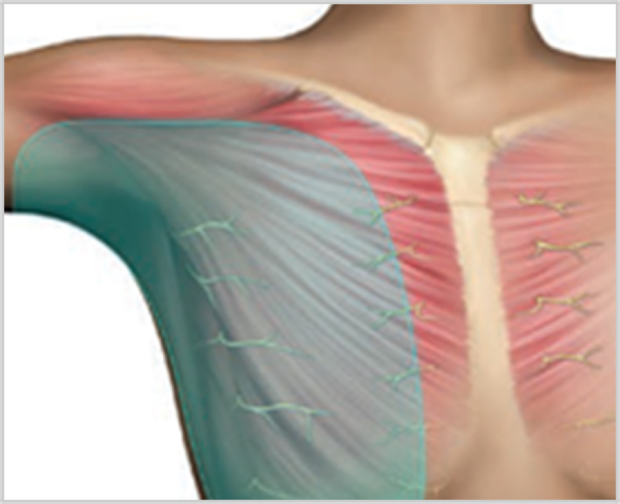 Anesthesia Field Block Pec