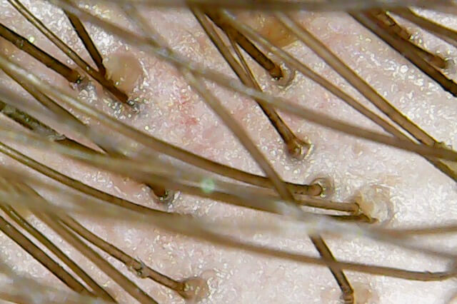 What Skin Under A Microscope Looks Like Gross But Fascinating Blog