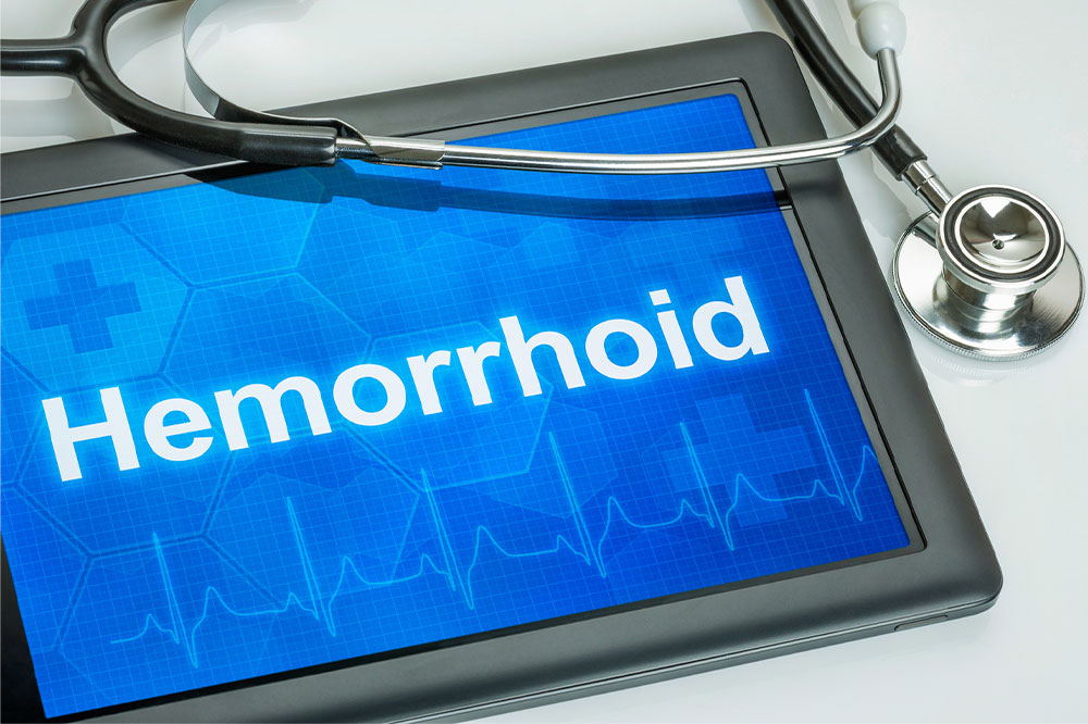 Hemorrhoids Causes Symptoms And Management Options