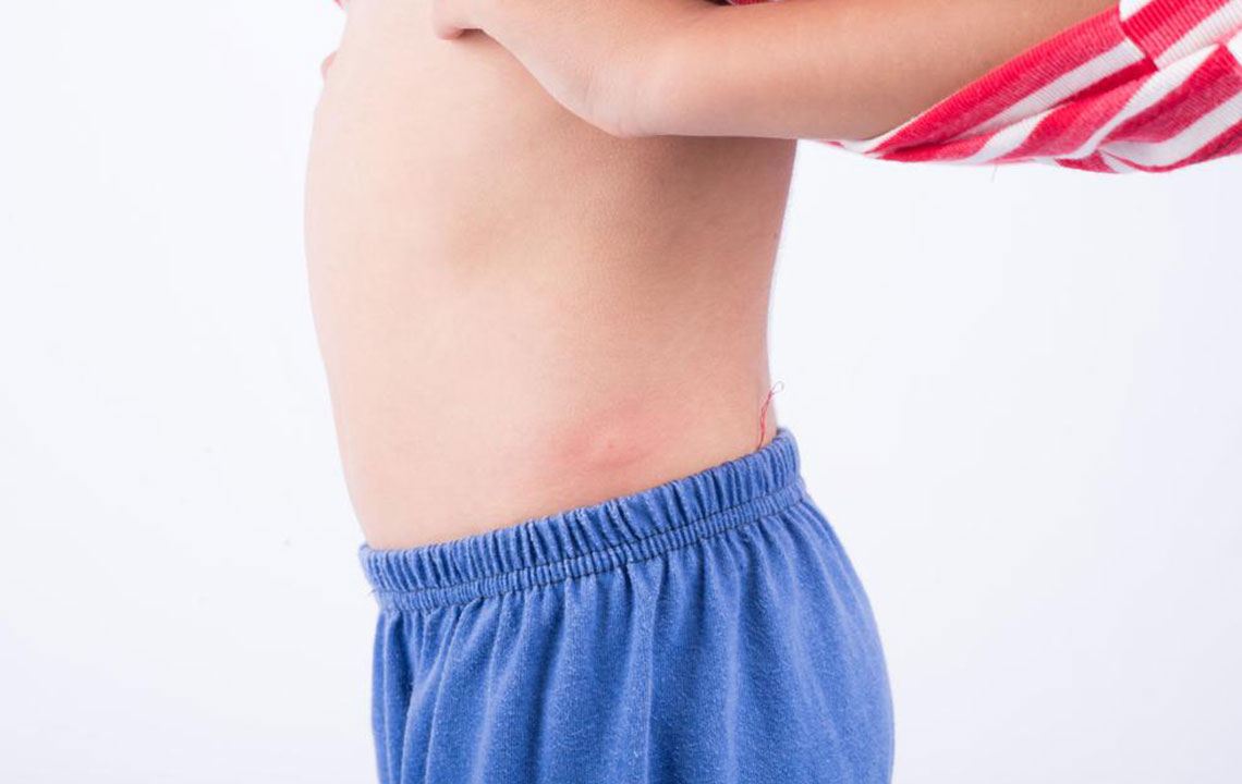 10 Common Types Of Skin Rashes You Should Be Aware Of