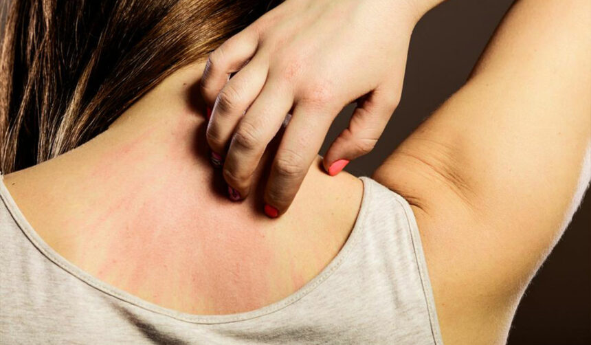 6 Natural Ways For Instant Relief From Itchy Skin