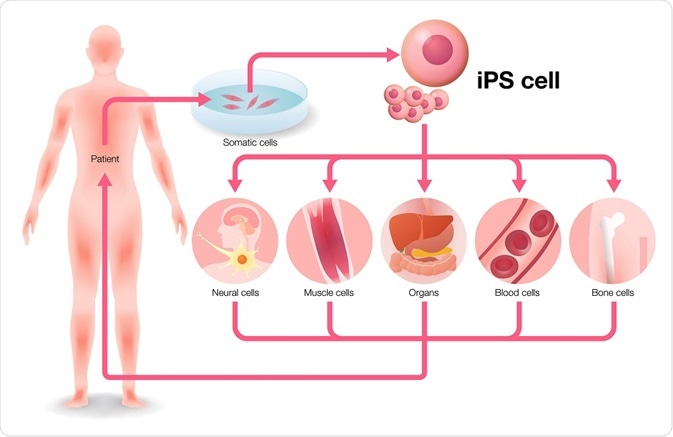 Induced Pluripotent Stem Cells