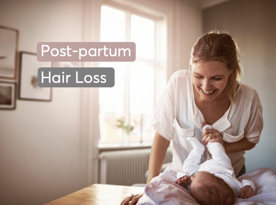 Causes And Treatments For Postpartum Hair Loss Mdhair