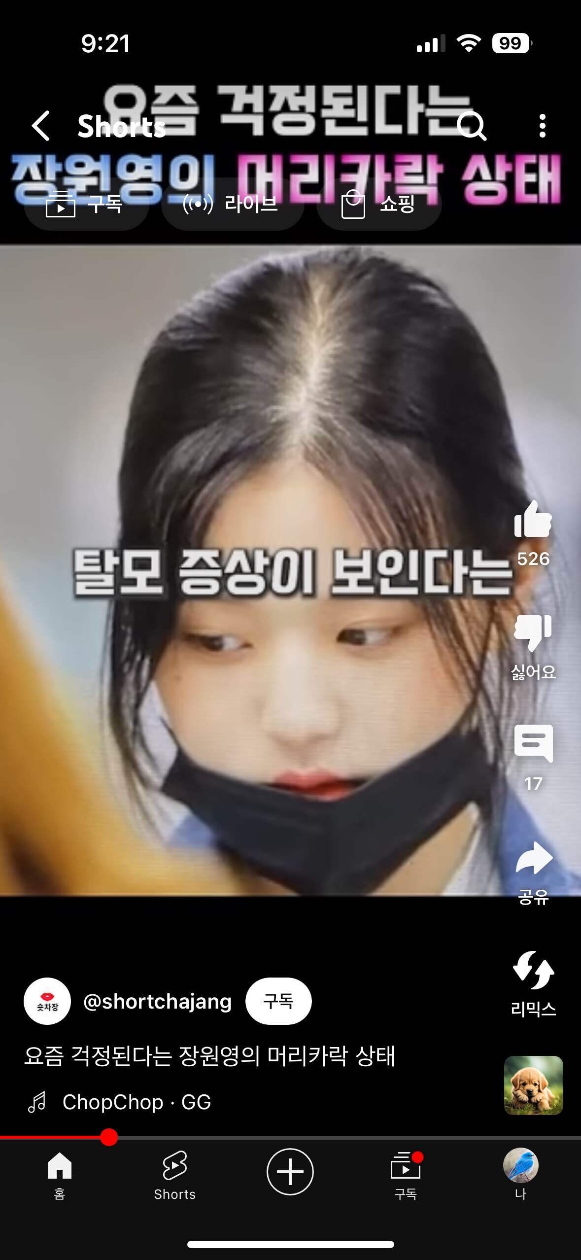 블라인드 블라블라 장원영 탈모 어케 관리했을까 ㅠㅠ