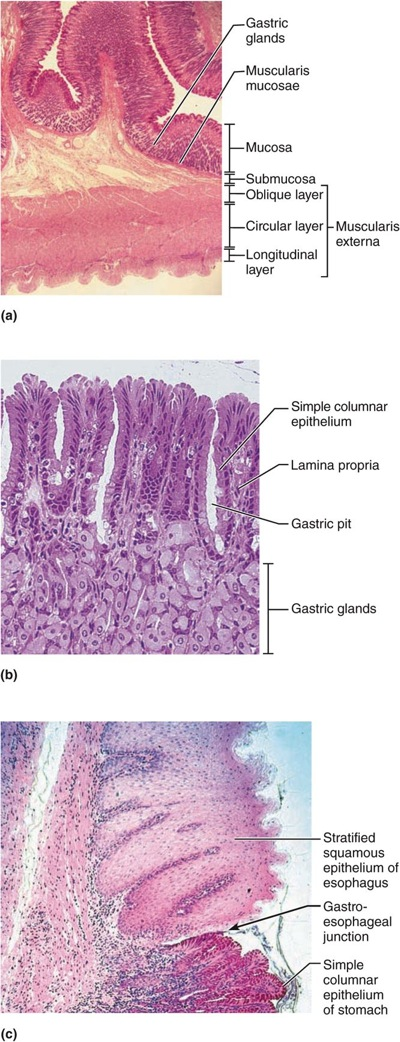 Stomach Histology Labeled Gastric Pits