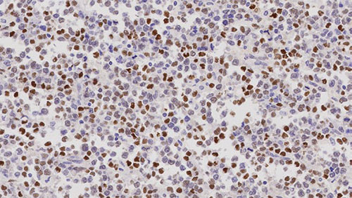 Cyclin D1 Ihc Primary Antibodies