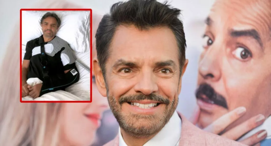 Eugenio Derbez Apareció Y Dijo La Verdad De Su Accidente Detalles Y