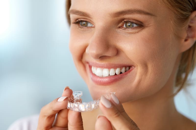 How Often Should I Whiten My Teeth Home Surrey Dentist