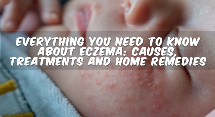 Everything You Need To Know About Eczema Causes Treatments And Home