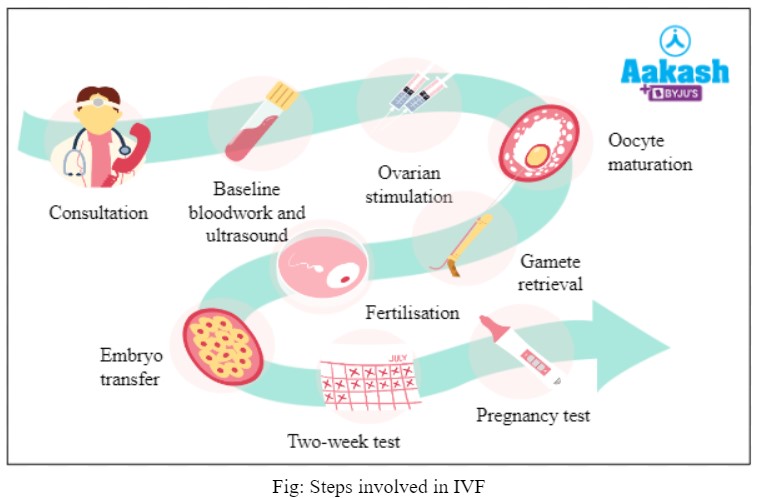 Ivf Meaning Treatment Steps And Significance Aesl