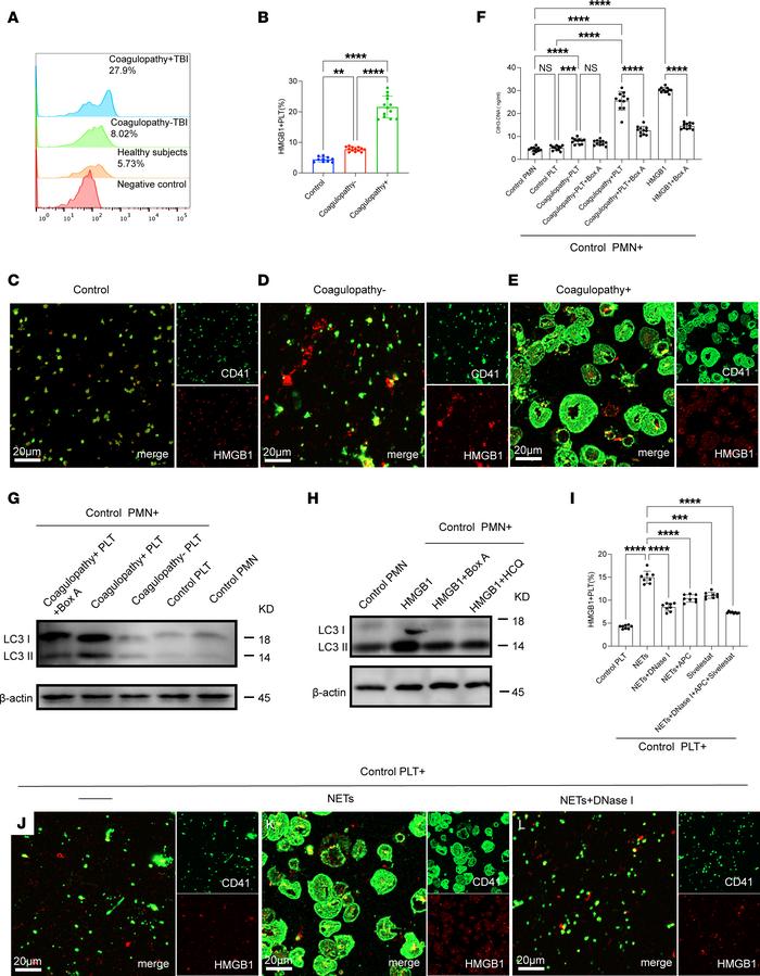 Jci Insight Neutrophil Extracellular Traps Contribute To Coagulopathy