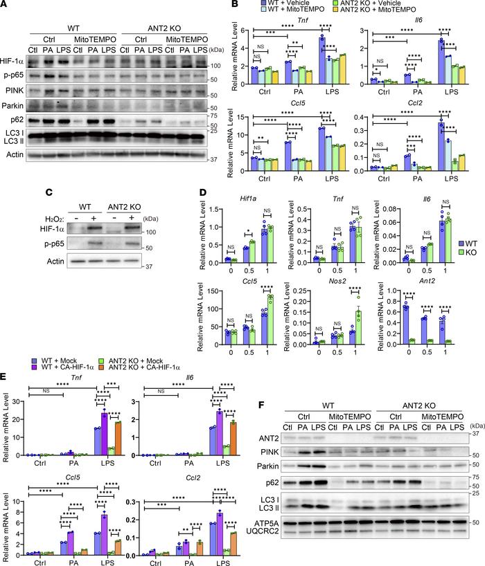 Jci Insight Ant2 Drives Proinflammatory Macrophage Activation In Obesity