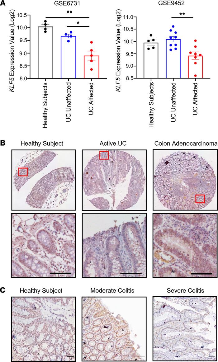 Jci Insight Klf5 Protects The Intestinal Epithelium Against Th17