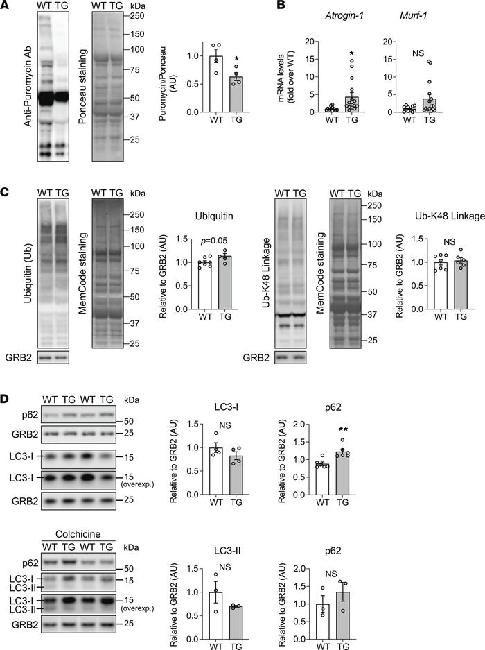 Jci Insight Frataxin Deficiency Lowers Lean Mass And Triggers The