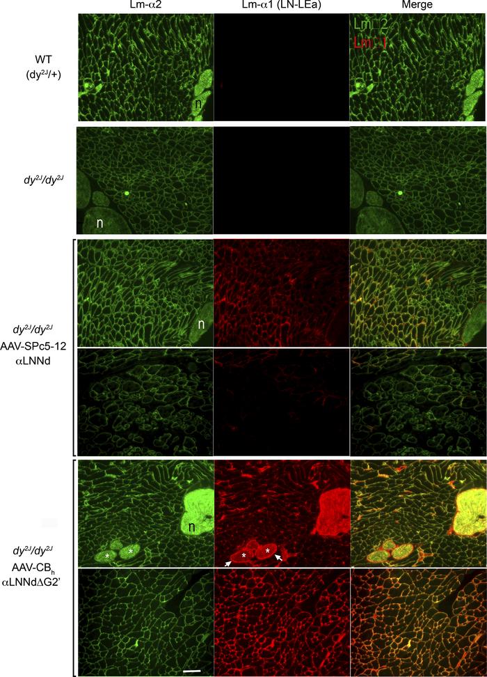 Jci Insight Amelioration Of Muscle And Nerve Pathology Of Lama2