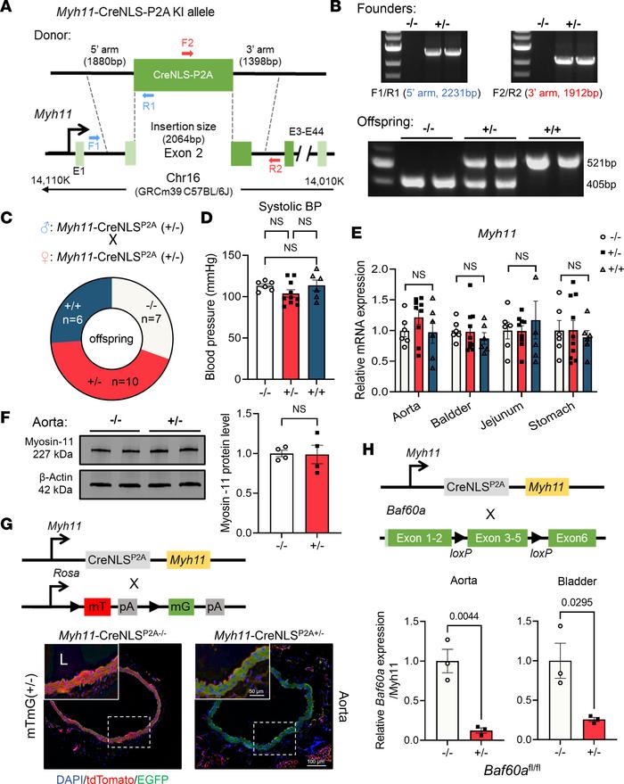 Jci Insight Generating Endogenous Myh11 Driven Cre Mice For Sex