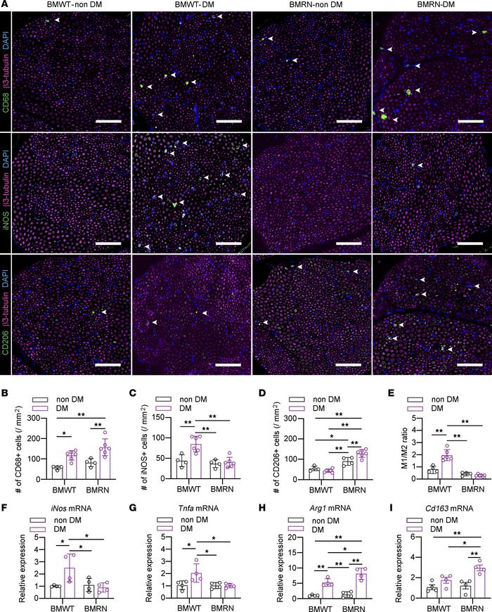 Jci Insight Rage Activation In Macrophages And Development Of