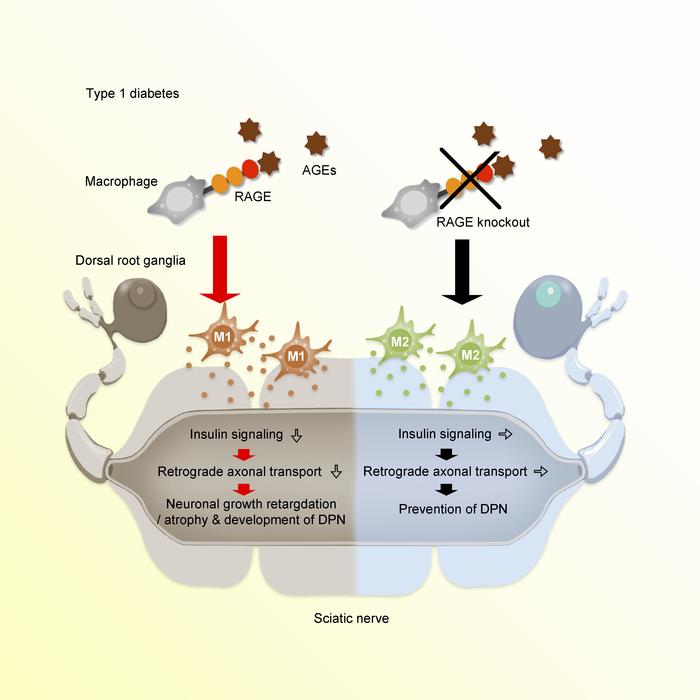 Jci Insight Rage Activation In Macrophages And Development Of