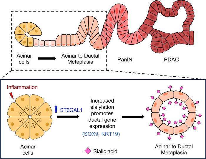 Jci Insight St6gal1 Sialyltransferase Promotes Acinar To Ductal