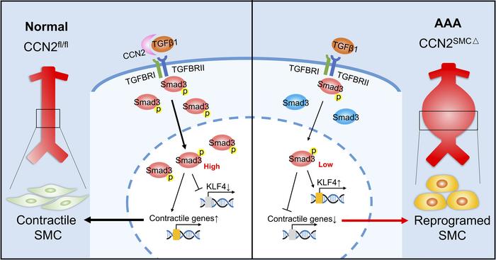 Jci Insight Ccn2 Deficiency In Smooth Muscle Cells Triggers Cell