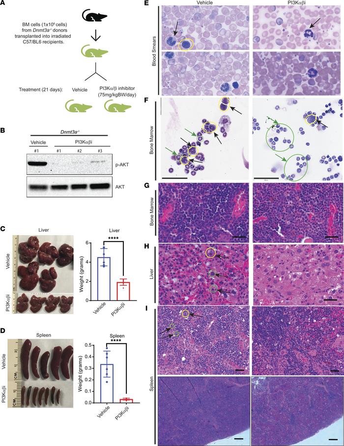 Jci Insight Loss Of Dnmt3a Impairs Hematopoietic Homeostasis And