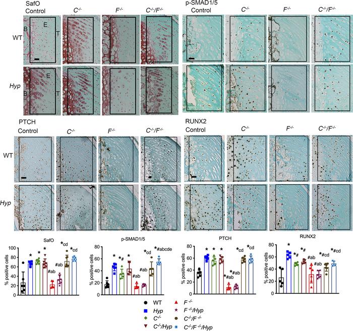 Jci Insight Impaired 125 Dihydroxyvitamin D3 Action Underlies